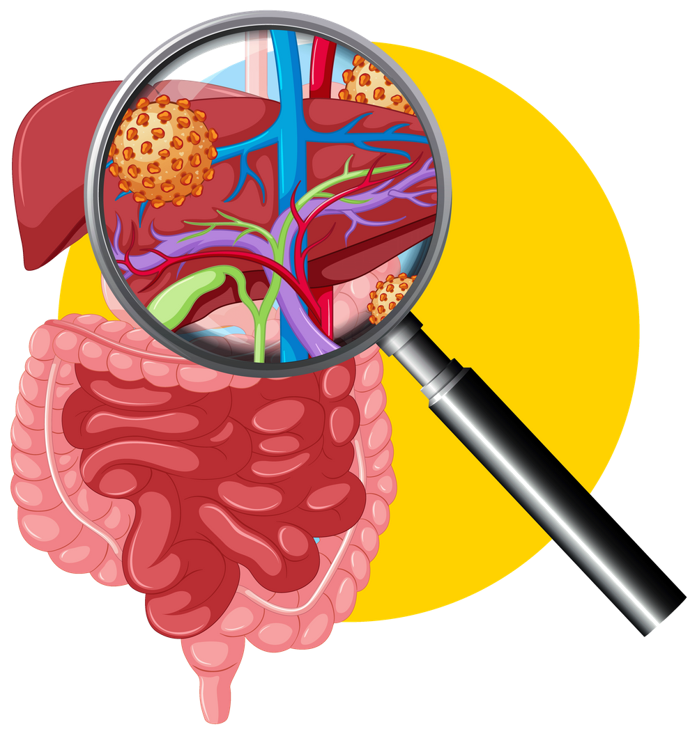 ToxOut - Natural Liver Cleanse by Steiger Naturals